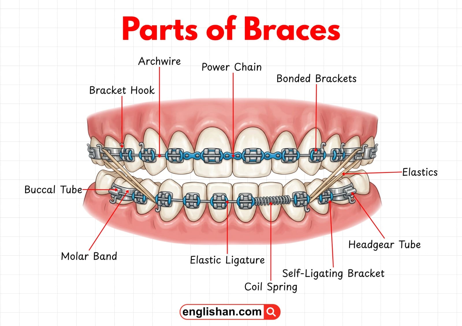 Parts of Braces: Complete Guide with Diagram and Function